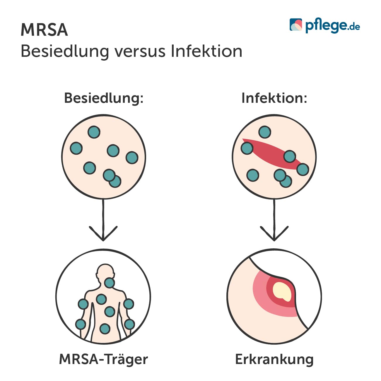Leichte Mrsa Infektion
